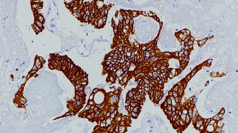 Cytokeratin 18（CK18） | 杭州百凌生物科技有限公司-官方网站