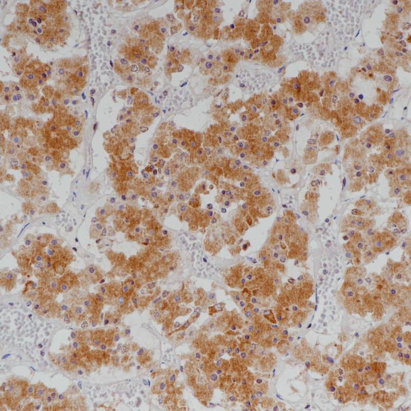 Cytokeratin 20（CK20） | 杭州百凌生物科技有限公司-官方网站